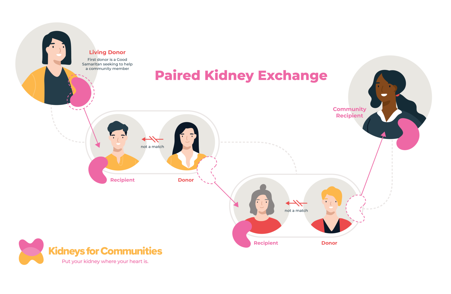 African Americans have less likelihood of receiving a living donor ...